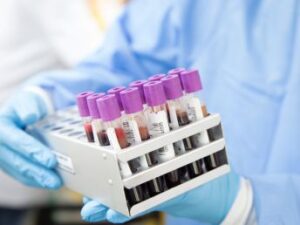 Toma de muestras de laboratorio a domicilio 24/7 - Andilab